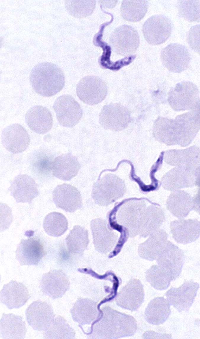 Trypanosoma Brucei Gambiense